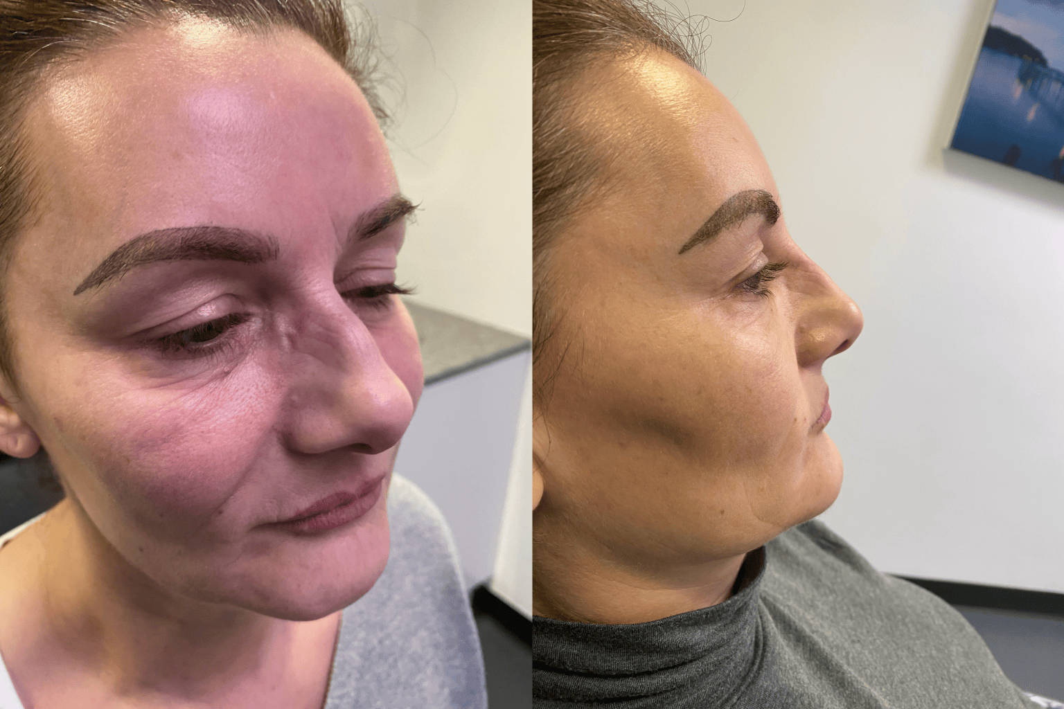 Face Up - JLife Magazine